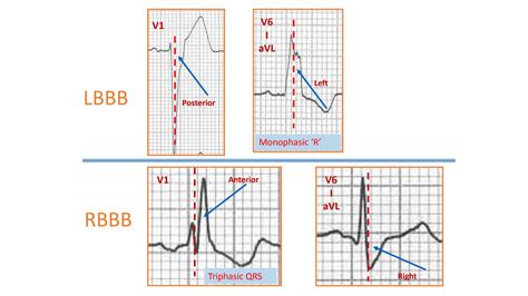 SOLUTION Work Assignment Day Bundle Branch And Fascicular Blocks Studypool