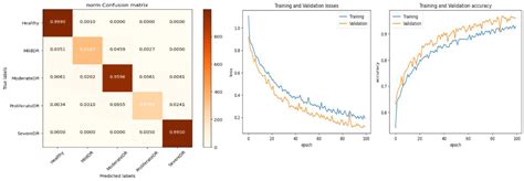 Dr Nasnet Automated System To Detect And Classify Diabetic Retinopathy Severity Using Improved
