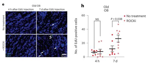 Stanford Researchers Successfully Reactivate Brain Stem Cells In Aging Mice Nad