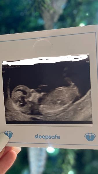 Gender Guesses 12 Week Scan Mumsnet