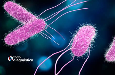 Bacteria Salmonella Spp Una Causa De Gastroenteritis Todo Diagnóstico
