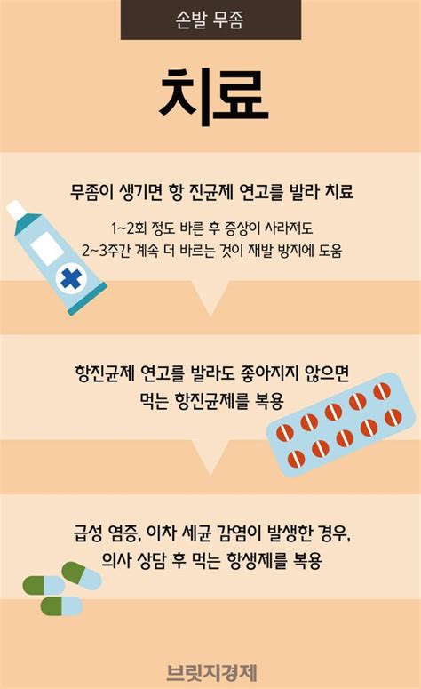 [카드뉴스] 간질간질 무좀 어떻게 잡을까 네이트 뉴스