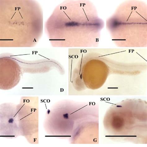 Scale Bar 025 Mm In Situ Hybridization Pattern Of Danio Rerio