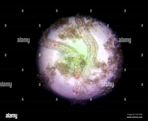 Nematode Germs Are Viewed Under A Microscope Revealing Their Unique