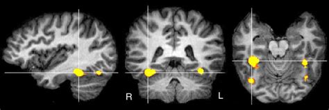 Fusiform Face Area Diagram