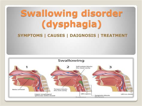 Dysphagia 嚥下障害をきたす疾患 What Is Dysphagia Difficulty Swallowing Kufi