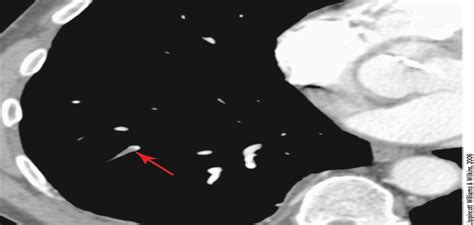 Emergency Medicine News