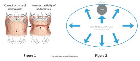 Abdominal Bracing Dr Steve Sikorsky