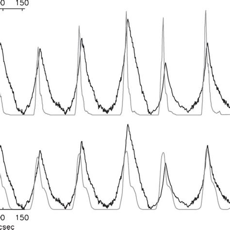 Schematic Diagram Of The Coagulation Cascade And Possible Interference Download Scientific