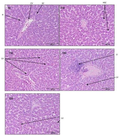 Liver Antioxidant Capacity And Steatosis In Laying Hens Exposed To