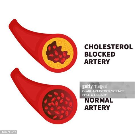 11 Lipid Icon High Res Illustrations Getty Images