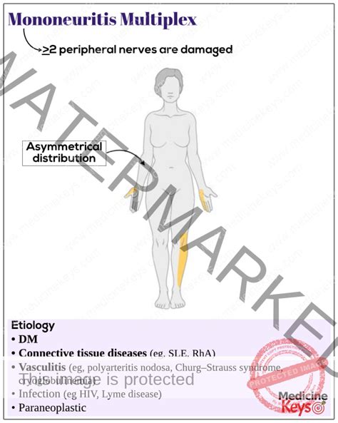 Mononeuritis Multiplex Medicine Keys For Mrcps