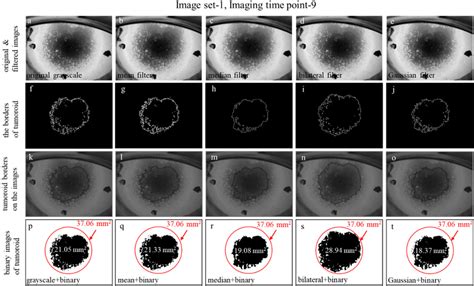 Preprocessing Of Images A Original Grayscale Image Be Filtered Download Scientific