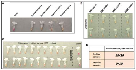 A Finger Actuated Sample Dosing Capillary Driven Microfluidic Device For Loop Mediated