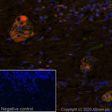 Alexa Fluor® 594 Anti Peripherin Antibody Epr23445 28 Ab275084 Abcam