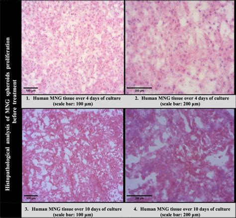 A Shotgun Proteomic Based Approach With A Q Exactive Hybrid Quadrupole Orbitrap High Resolution