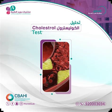 تحليل الكوليسترول مختبرات وريد الطبية