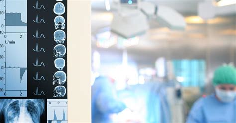 Parkinsons Disease Research Patients To Sleep During Deep Brain Stimulation