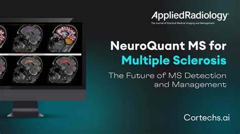 Neuroquant Ms The Future Of Multiple Sclerosis Detection And Management Cortechsai