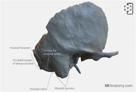 Temporal Bone Ar Atlas