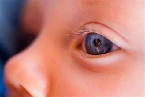 علت تغییر رنگ چشم نوزادان ، چه زمانی رنگ چشم دائمی میشود