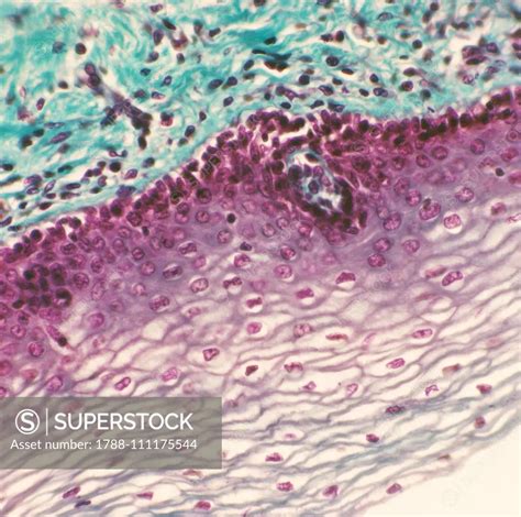 Squamous Epithelial Cell From A Human Vagina Seen Under A Microscope At X210 Magnification