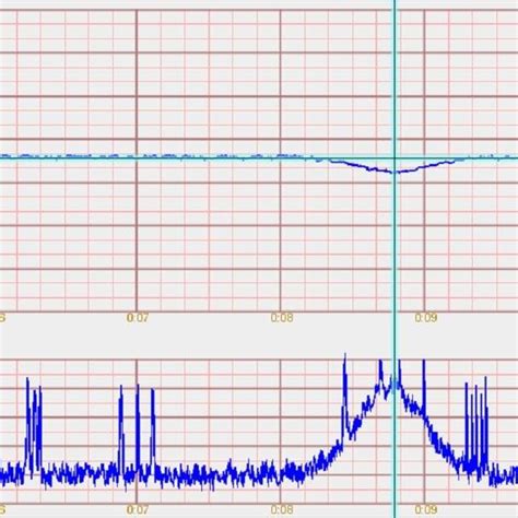 A Simulated Early Decel Left And Late Decel Right Download Scientific Diagram