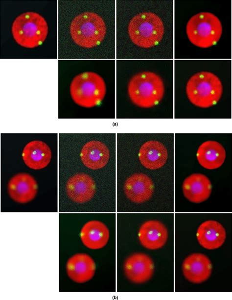 Application Of Different Denoising Algorithms Over Multichannel
