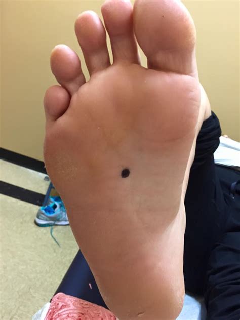 On Yongquan Point The Qi Facilitator The Best Health Journey