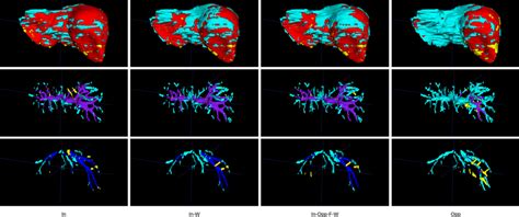 Comparison Of Liver Segmentation Performance With Different Model Download Scientific Diagram