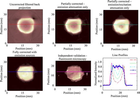 A An Uncorrected Image Reconstructed Using Filtered Back Projection Download Scientific