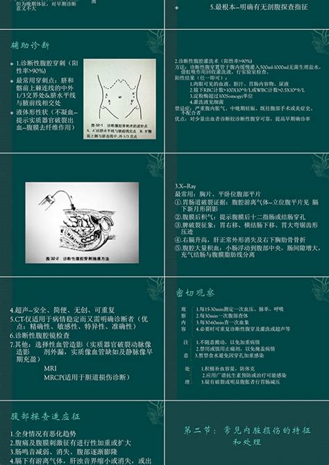 腹部外伤PPT模板 卡卡办公