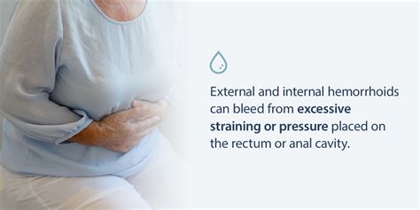 Hemorrhoids Bleeding