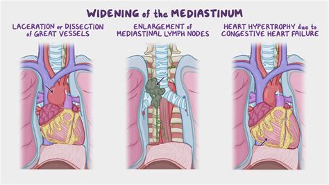 Posterior Mediastinum Structures