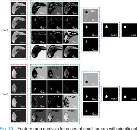 Figure 10 From Automatic Liver Tumor Segmentation On Dynamic Contrast Enhanced Mri Using 4d