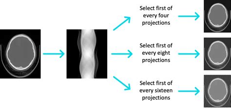 Figure 2 From Impact Of Upstream Medical Image Processing On Downstream Performance Of A Head Ct