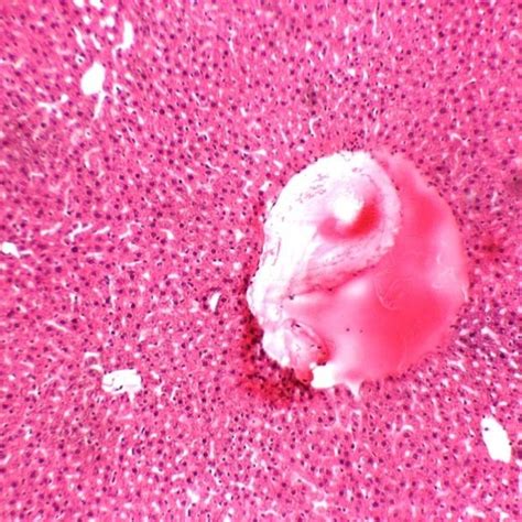Liver Of Asa Group Showing Dilated Central Vein Filled By Hemolyzed