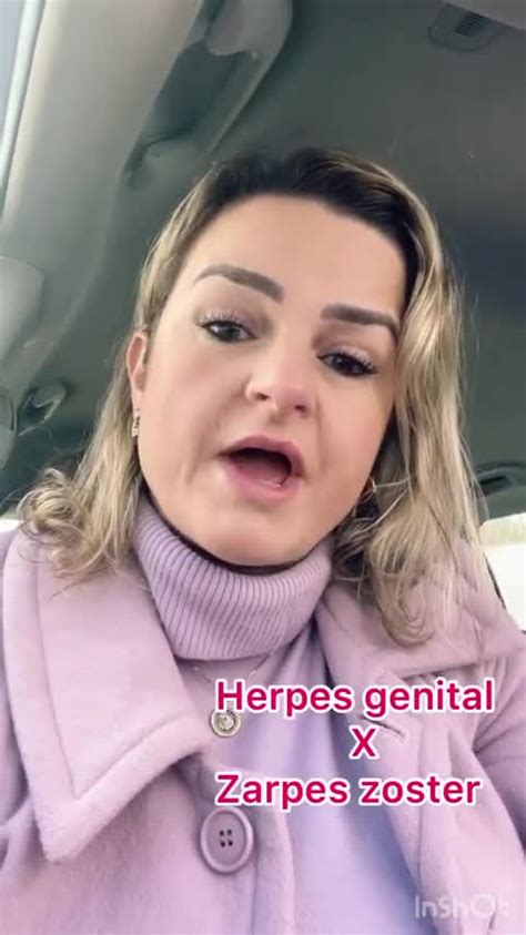 Varicela Varíola Varíola Dos Macacos Herpes Genital Herpes Zoster
