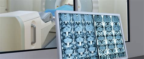 What Are The Risks Of Nuclear Imaging