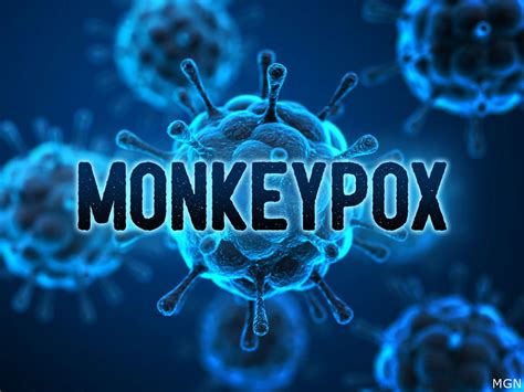 Presumptive Monkeypox Case Identified In Colorado KRDO