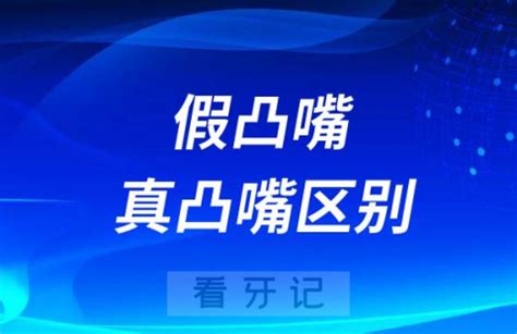 假凸嘴真凸嘴区别及自测方法别再查知乎了 看牙记网