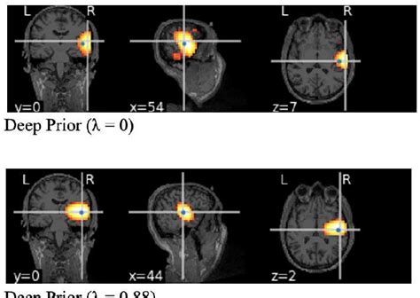 Figure 3 From Current Source Localization Using Deep Prior With Depth
