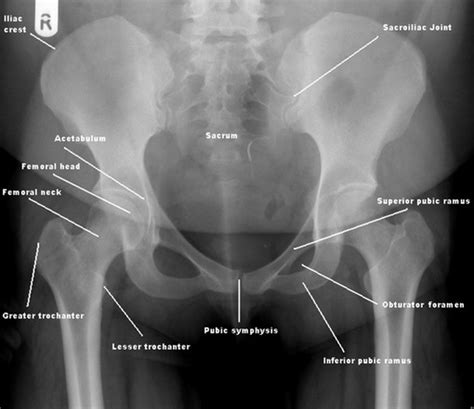Normal Hip Joint Anatomy Xray Leryuno