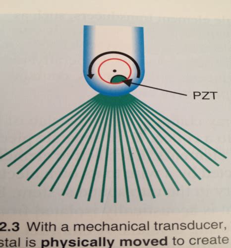 Two Dimensional Imaging Flashcards Quizlet