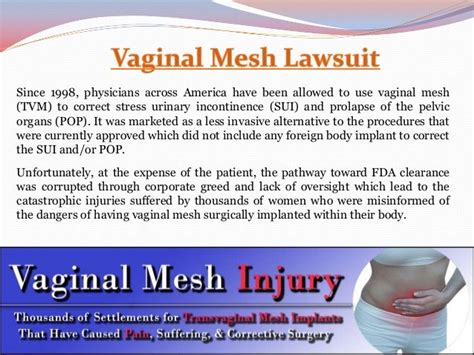 Transvaginal Mesh Lawsuit