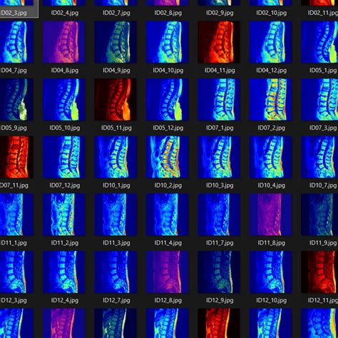 Lumbar Coordinate Colorized Dataset Kaggle