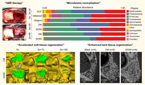 연세대 홍진기 교수팀 구강 미생물과 건강하게 소통하여 잇몸과 뼈를 동시에 재생시키는 치과 임플란트용 멤브레인 개발
