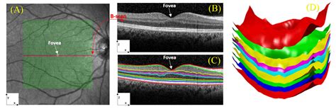 Development And Application Of Variational Techniques For Segmentation And Quantification Of