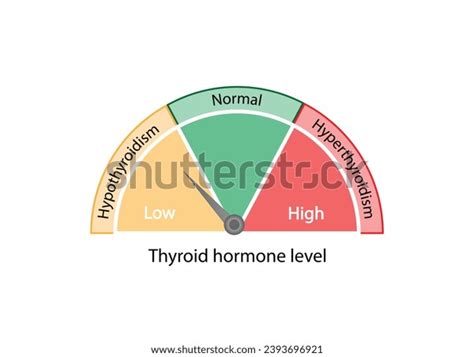 Thyroid Function Test Thyroid Gland Hypothyroidism Stock Vector