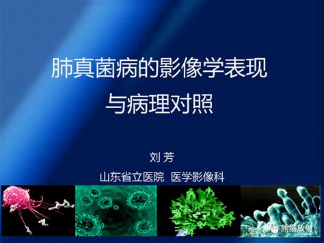 肺真菌病丨影像学表现与病理对照 熊猫